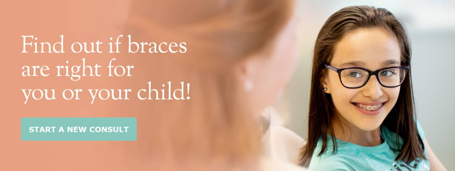 Bonding Braces: 5 Facts to Know About Bracket Cement